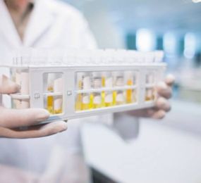 Leadvent Group| Bioprocess Intensification: Doing More with Less in ...