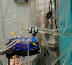 Leadvent Group| bioprocessing, real-time monitoring, analytics, process analytical technology ...